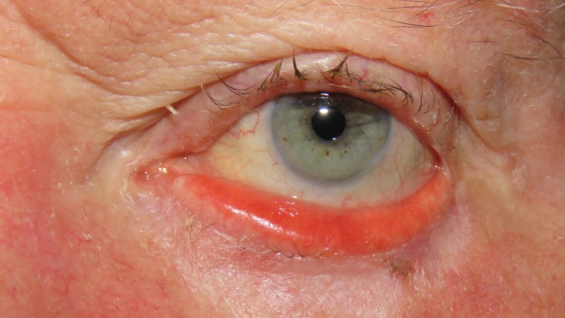 Dr Mpopi Lenake Practice - The Eye Centre